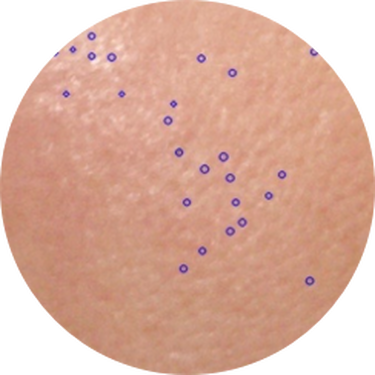 Discover Skin Analysis Tool | Skin Screen Protection | Lancôme