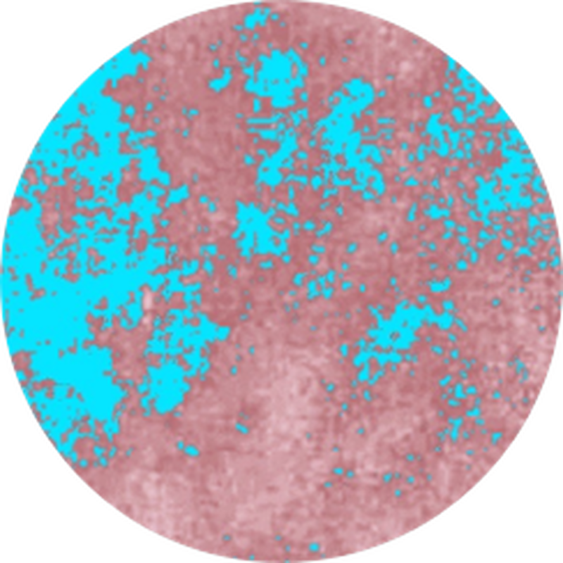 Discover Skin Analysis Tool | Skin Screen Protection | Lancôme