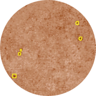 Discover Skin Analysis Tool | Skin Screen Protection | Lancôme