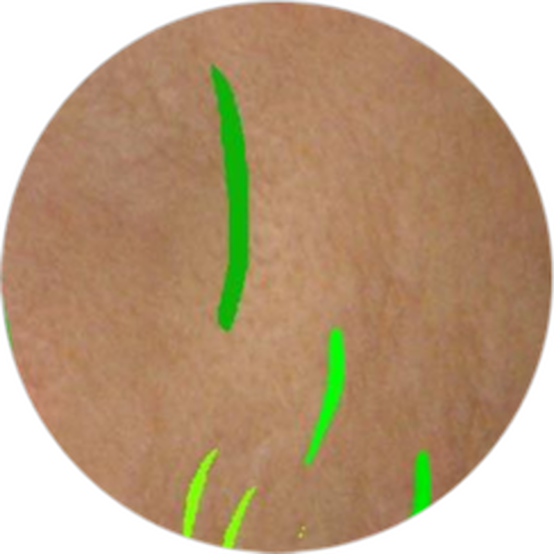 Discover Skin Analysis Tool | Skin Screen Protection | Lancôme