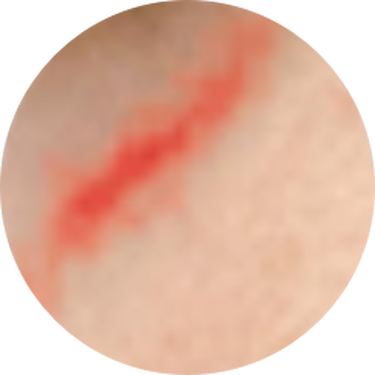 Discover Skin Analysis Tool | Skin Screen Protection | Lancôme