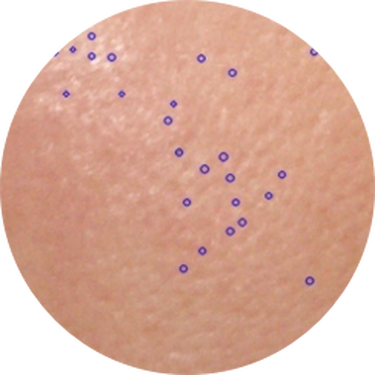 Discover Skin Analysis Tool | Skin Screen Protection | Lancôme
