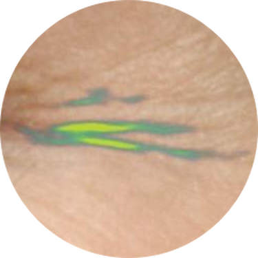 Discover Skin Analysis Tool | Skin Screen Protection | Lancôme