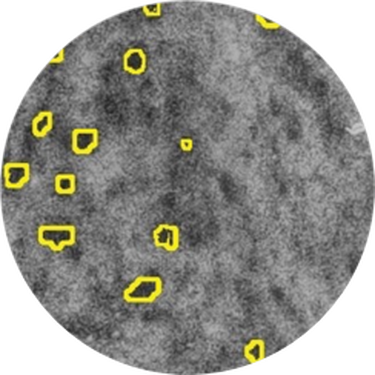 Discover Skin Analysis Tool | Skin Screen Protection | Lancôme